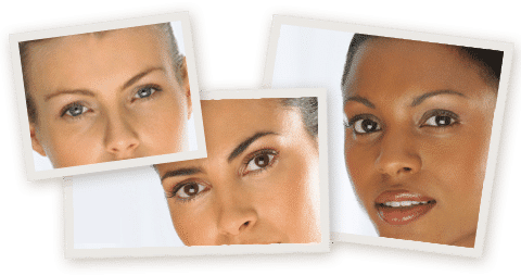 Juvaderm Voluma XC | Facial Cheek Filler