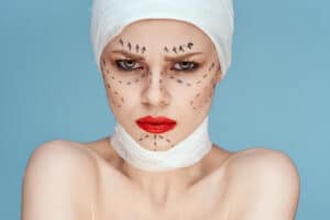 Botched Surgery Before and After – Risks and Fixes